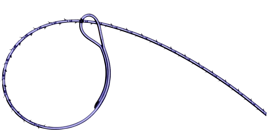 information-on-barbed-sutures-dolphin-sutures